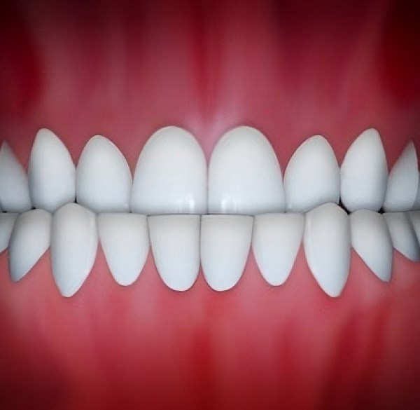 Common Orthodontic Problems | Patient Info KOKO orthodontics